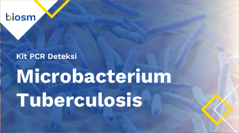 Kit Deteksi Microbacterium Tuberculosis (TB) - Info Biosains Medika ...
